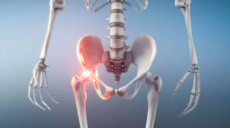Pubalgia, o que é? – Dr. Márcio Pozzi